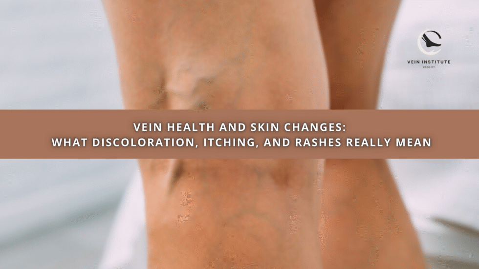 Vein Health and Skin Changes: What Discoloration, Itching, and Rashes ...