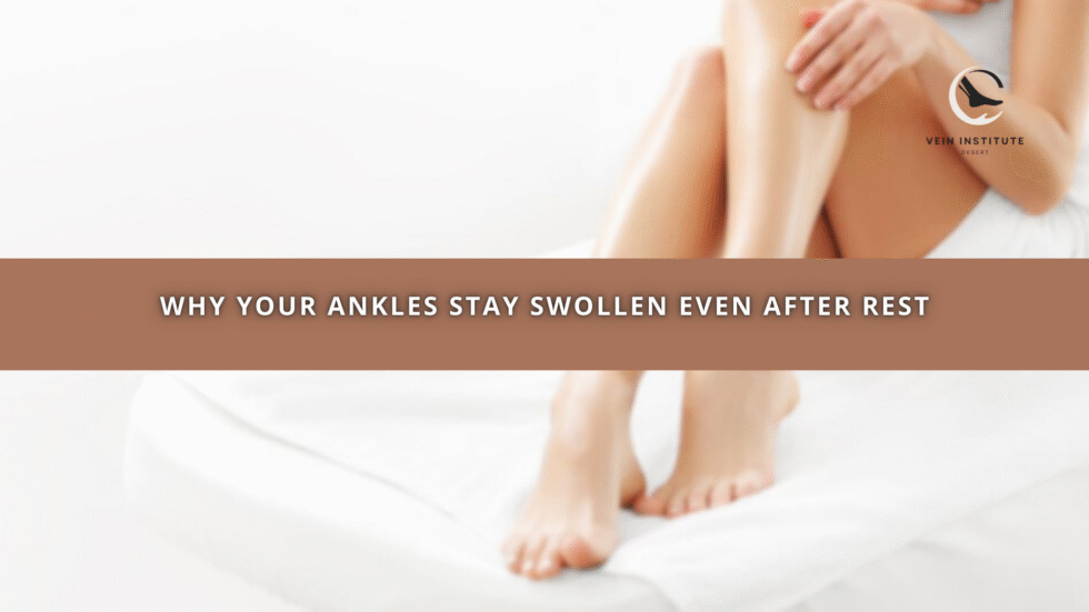 Why Your Ankles Stay Swollen Even After Rest - Vein Institute of the Desert