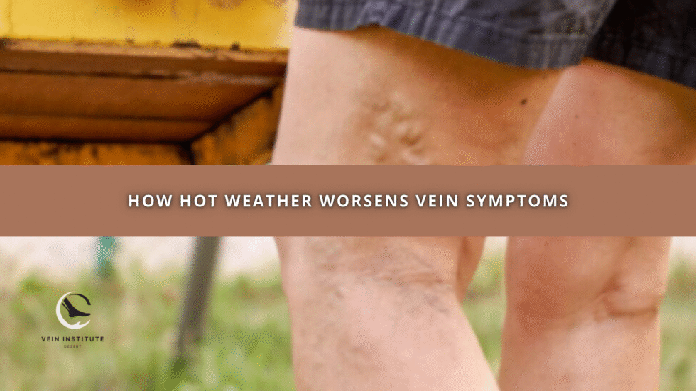 How Hot Weather Worsens Vein Symptoms - Vein Institute of the Desert