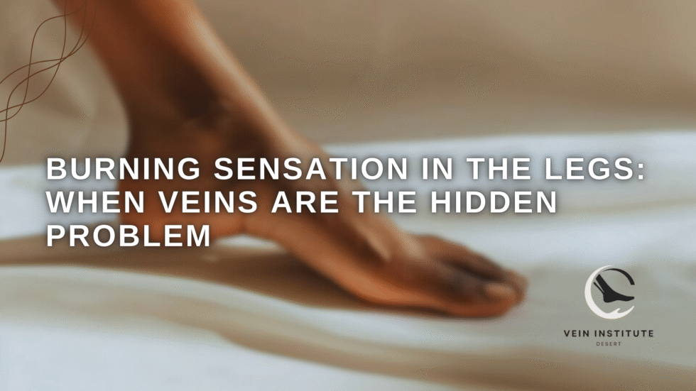 Burning Sensation in the Legs: When Veins Are the Hidden Problem